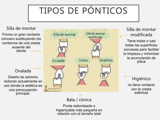 ponticos.pptx