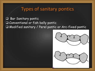 Pontics Kashish | PPTX