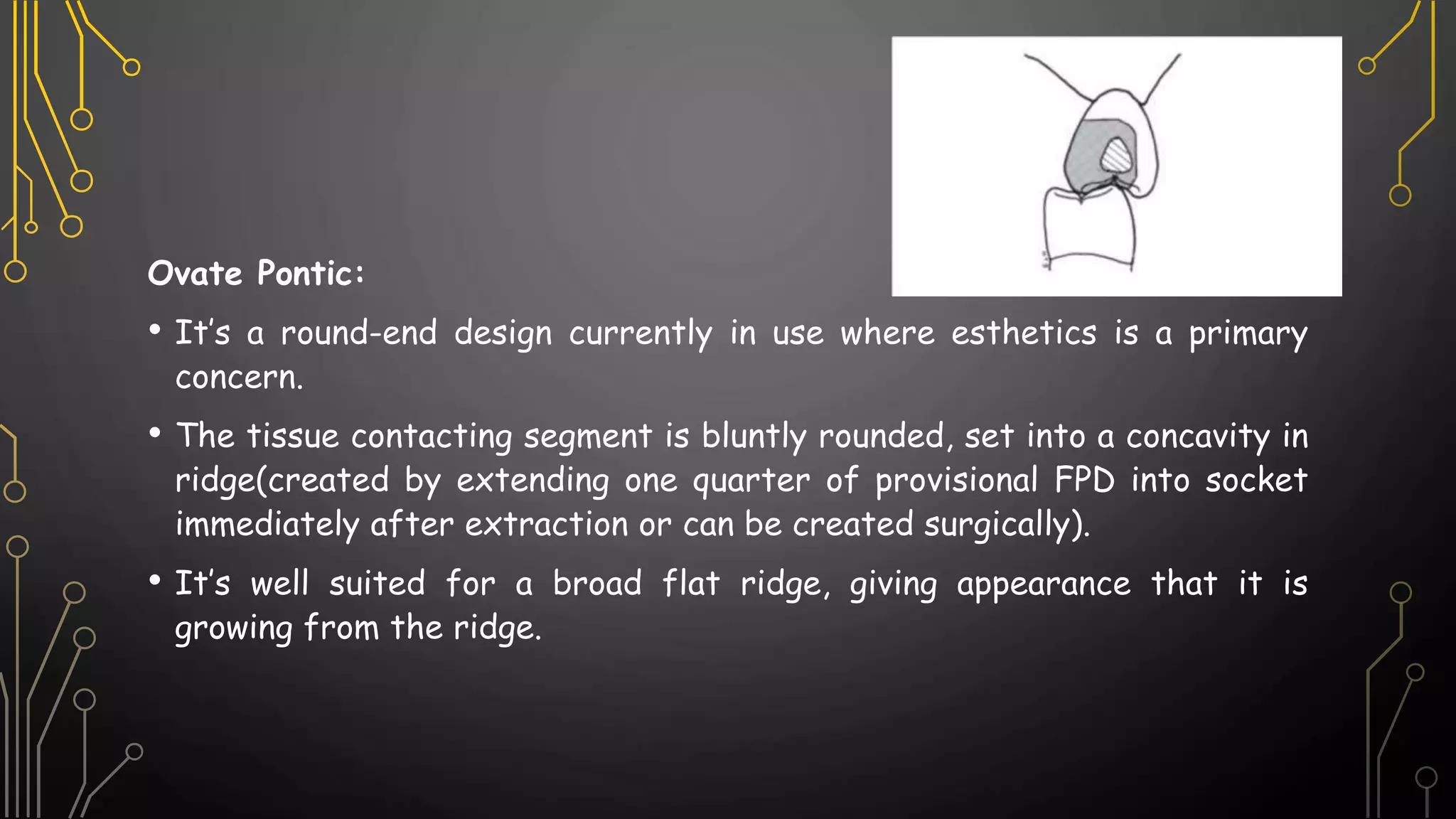 Pontics in Fixed Partial Denture | PPTX