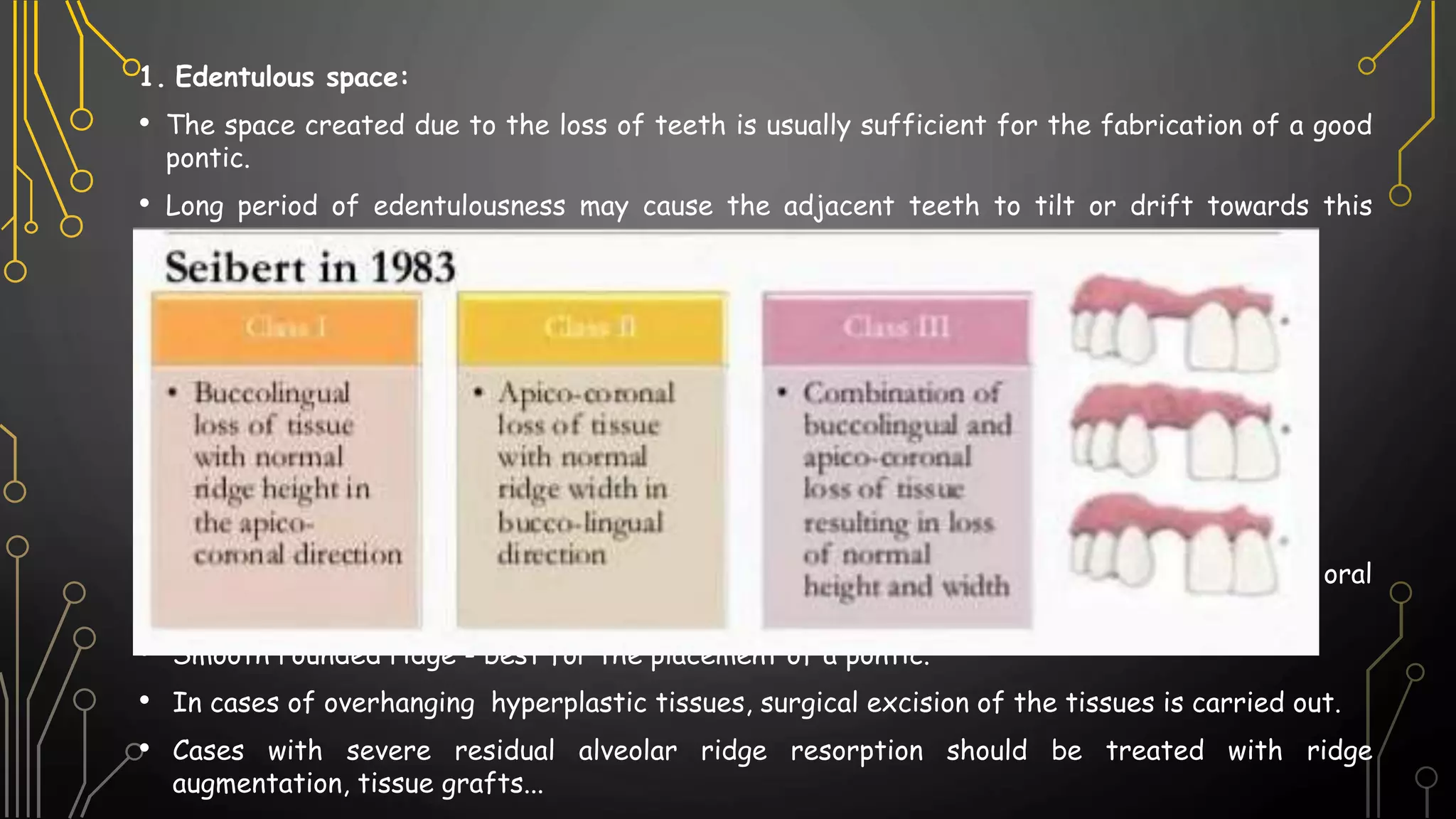 Pontics in Fixed Partial Denture | PPTX
