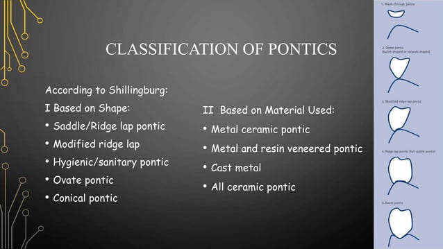 Pontics in Fixed Partial Denture | PPTX
