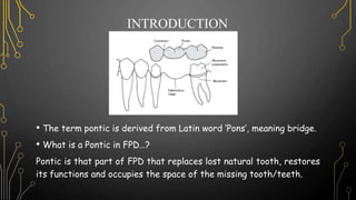 Pontics in Fixed Partial Denture | PPTX