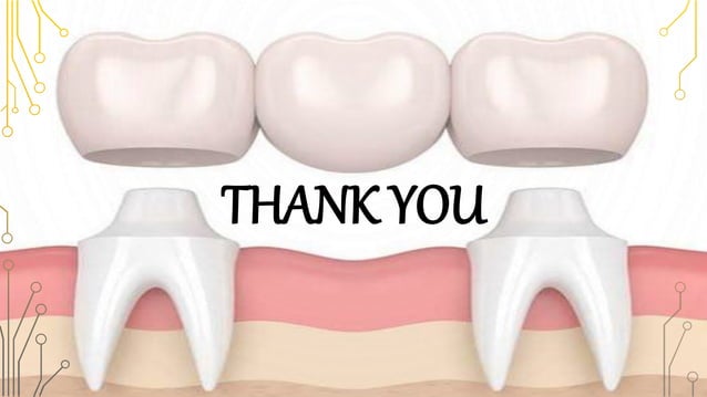 Pontics in Fixed Partial Denture | PPTX