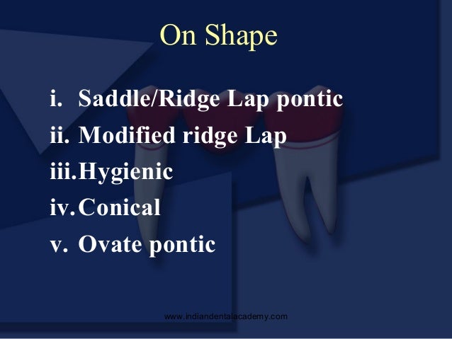 Pontics /certified fixed orthodontic courses by Indian dental academ…