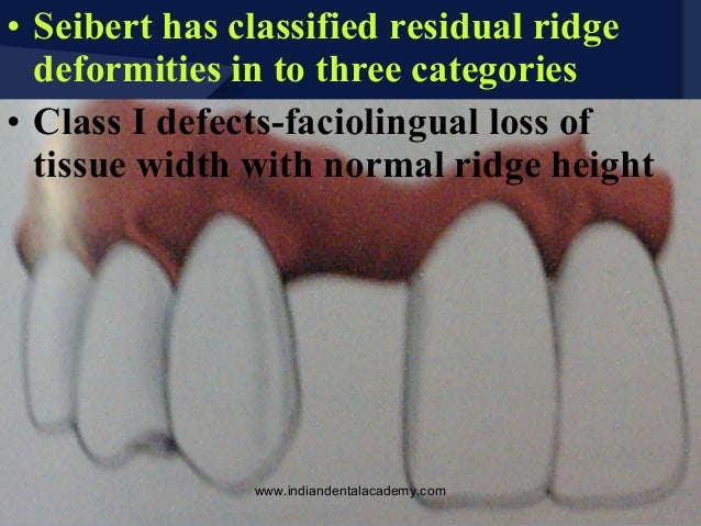 Pontics / orthodontic continuing education