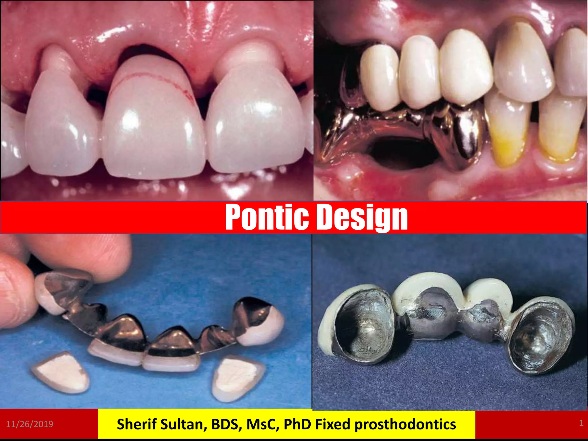 Pontics 1 | PPTX