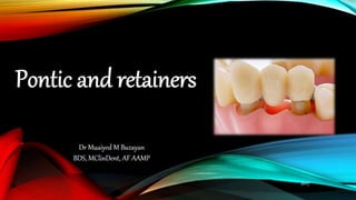 Pontics and retainers | PPT