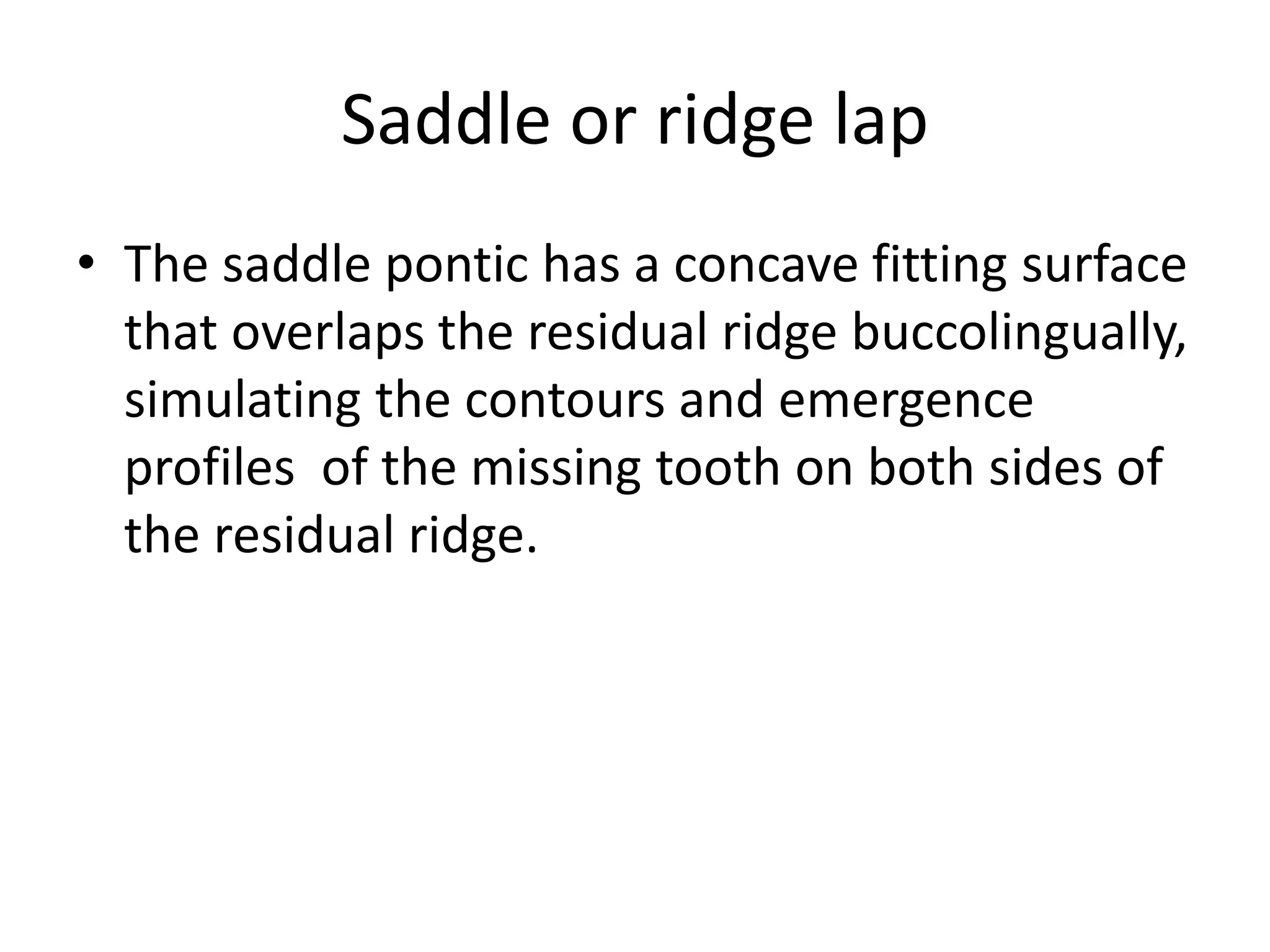 Pontics and Retainers | PPTX