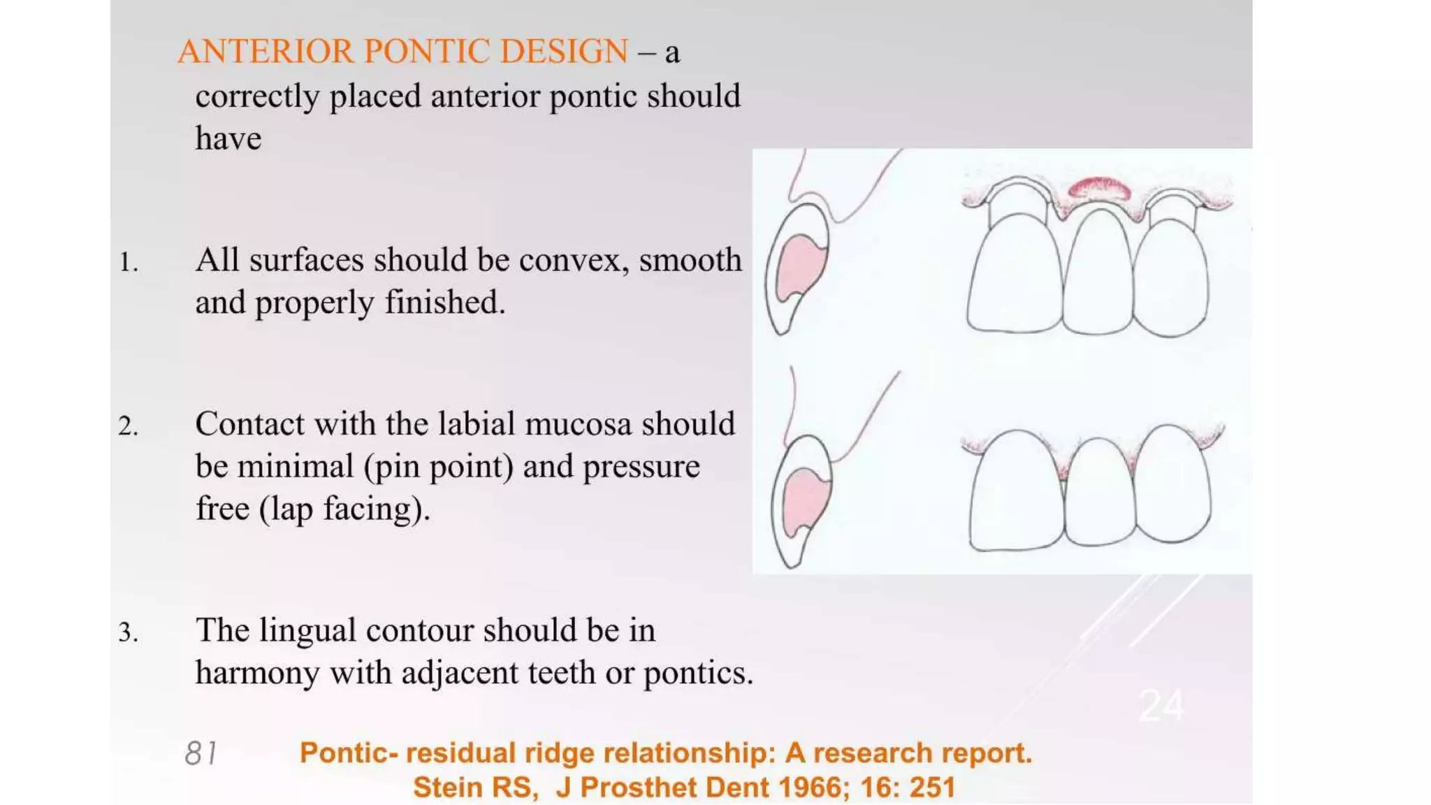 PONTICS IN FIXED PARTIAL DENTURE.pptx