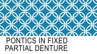 PONTICS IN FIXED PARTIAL DENTURE.pptx