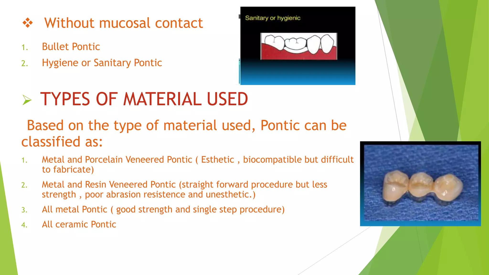 Pontics in fpd | PPTX