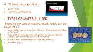 Pontics in fpd | PPT