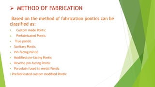 Pontics in fpd | PPTX | Dental Health | Diseases and Conditions