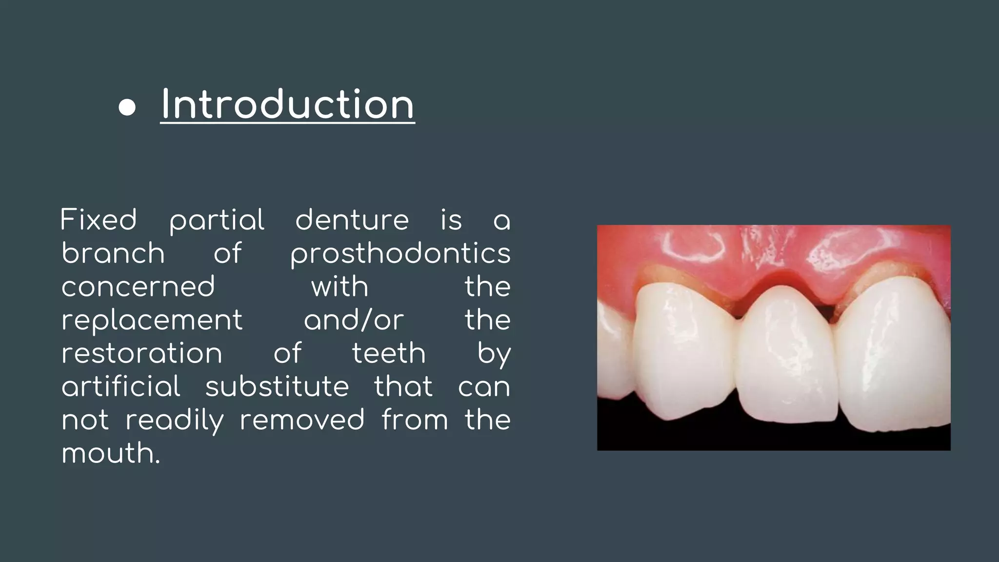 Pontics in fpd by Dr. Khirabdhi T Mishra | PPTX