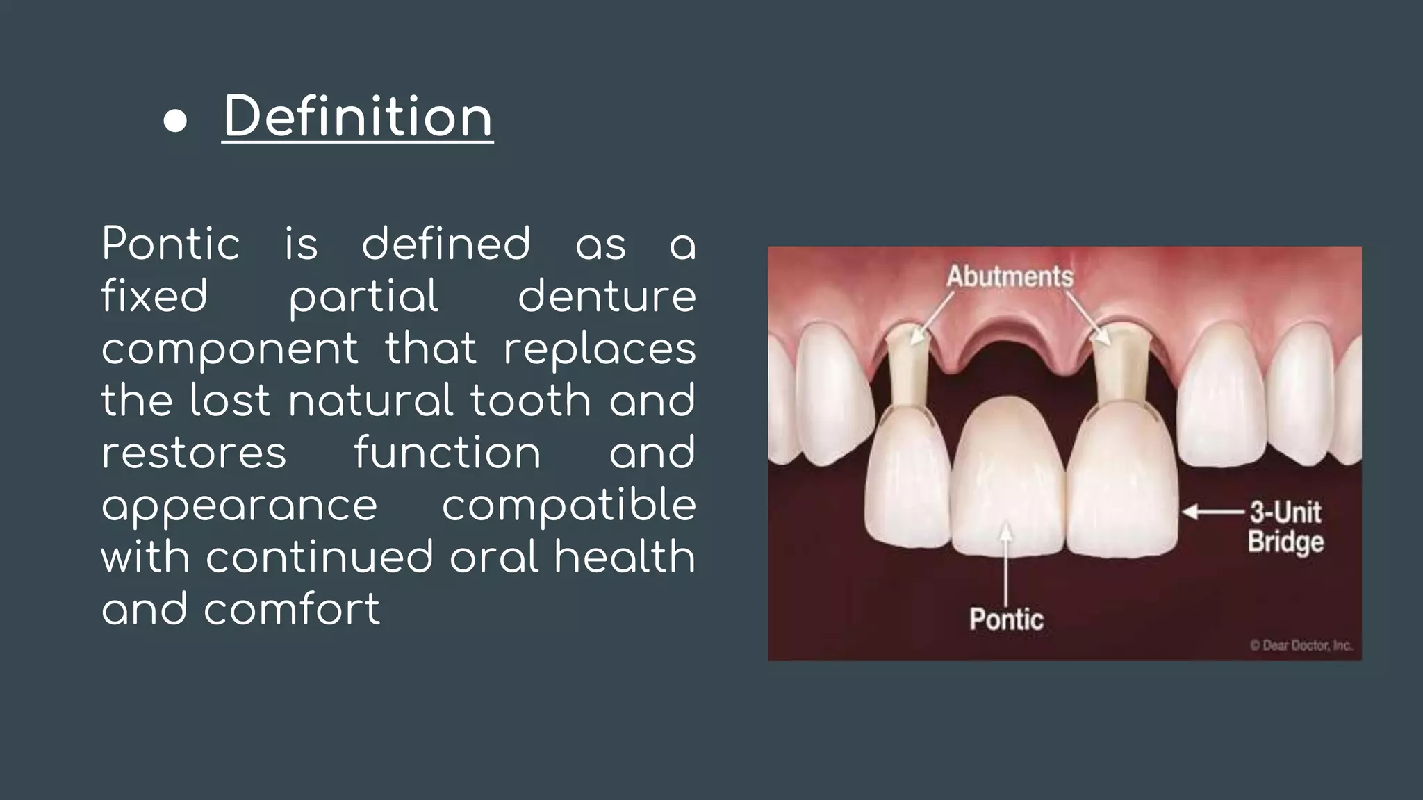 Pontics in fpd by Dr. Khirabdhi T Mishra | PPTX