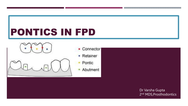 PONTICS IN Fixed partial denture - Prodthodontics.pptx | Dental Health ...