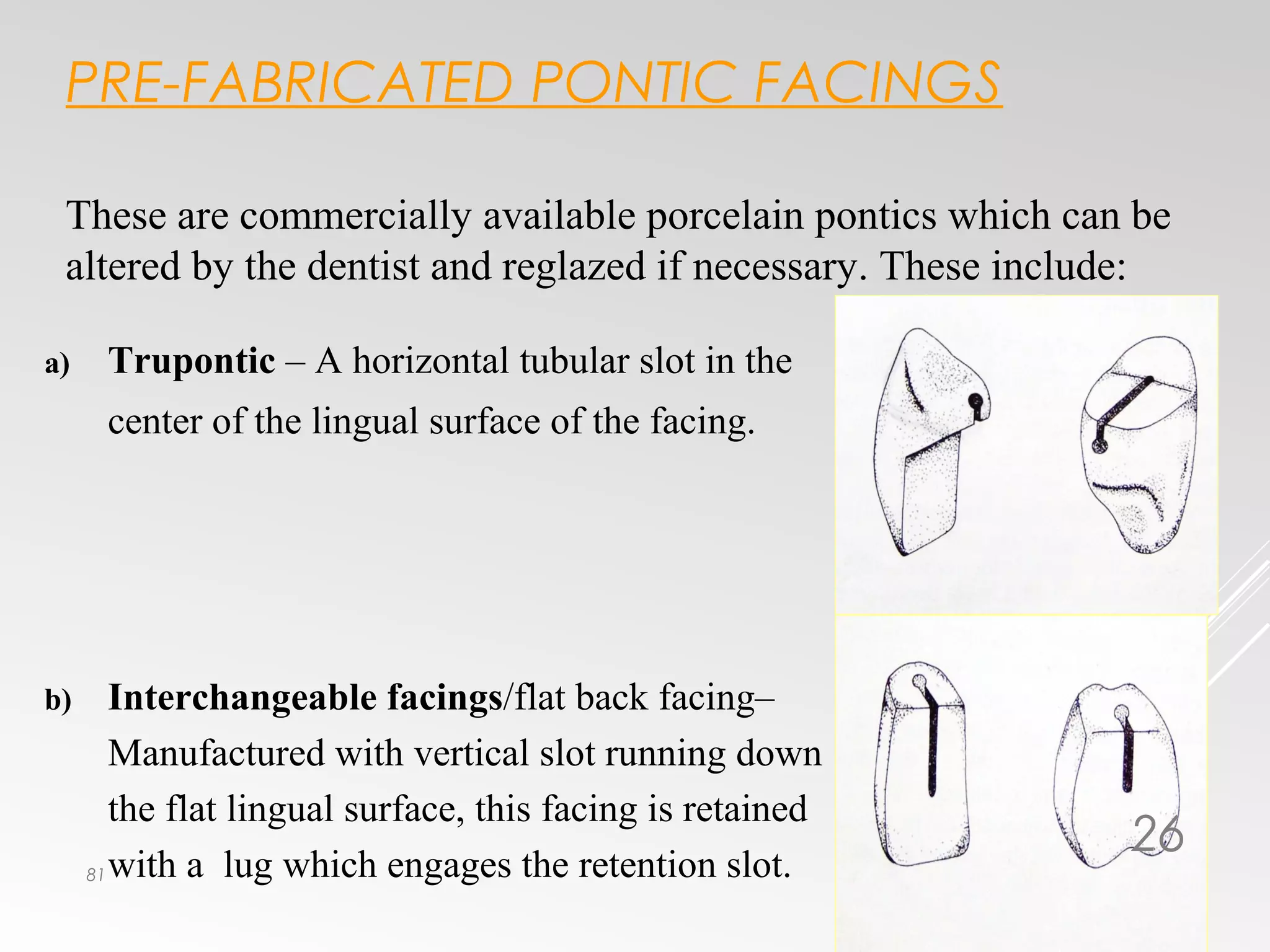 Pontics in Fixed Partial Dentures | PPT
