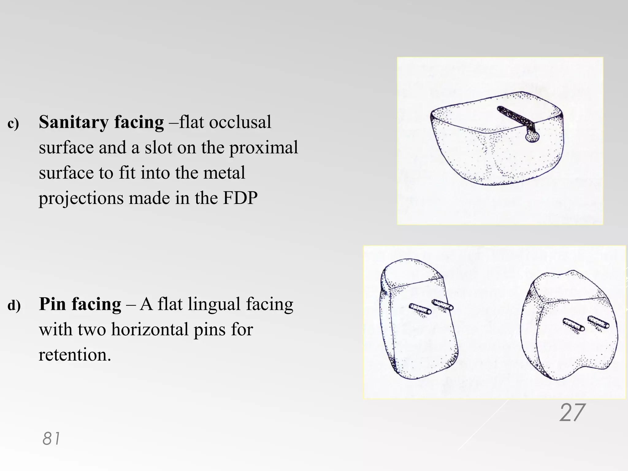 Pontics in Fixed Partial Dentures | PPT