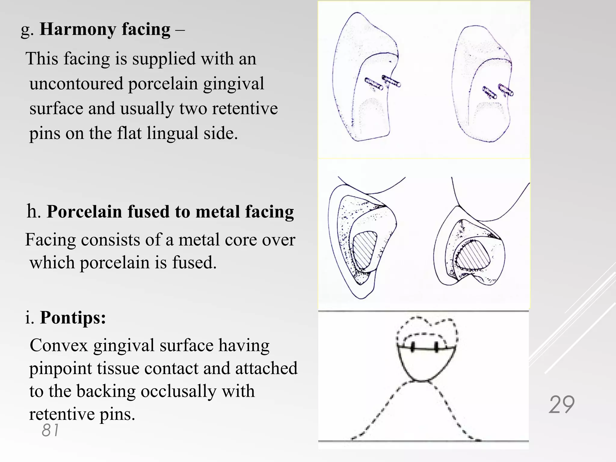 Pontics in Fixed Partial Dentures | PPT
