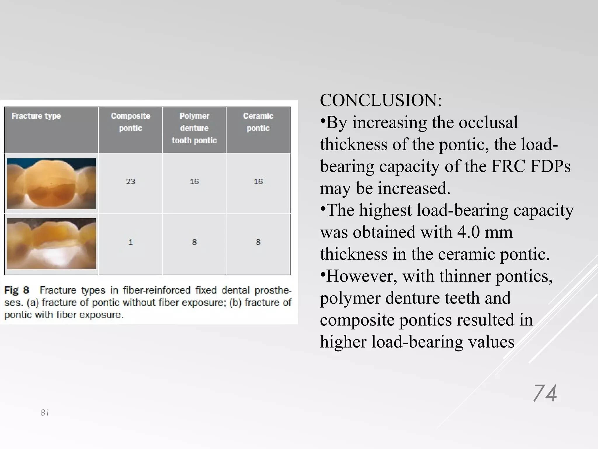 Pontics in Fixed Partial Dentures | PPT