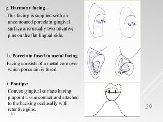 Pontics in Fixed Partial Dentures | PPT