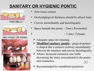 Pontics in Fixed Partial Dentures | PPT