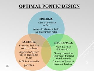 Pontics in Fixed Partial Dentures | PPT