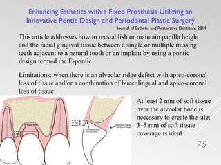 Pontics in Fixed Partial Dentures | PPT