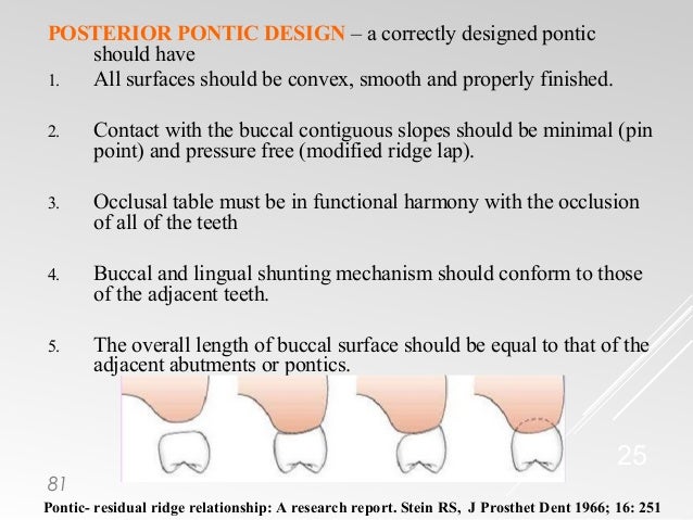 Pontics in Fixed Partial Dentures