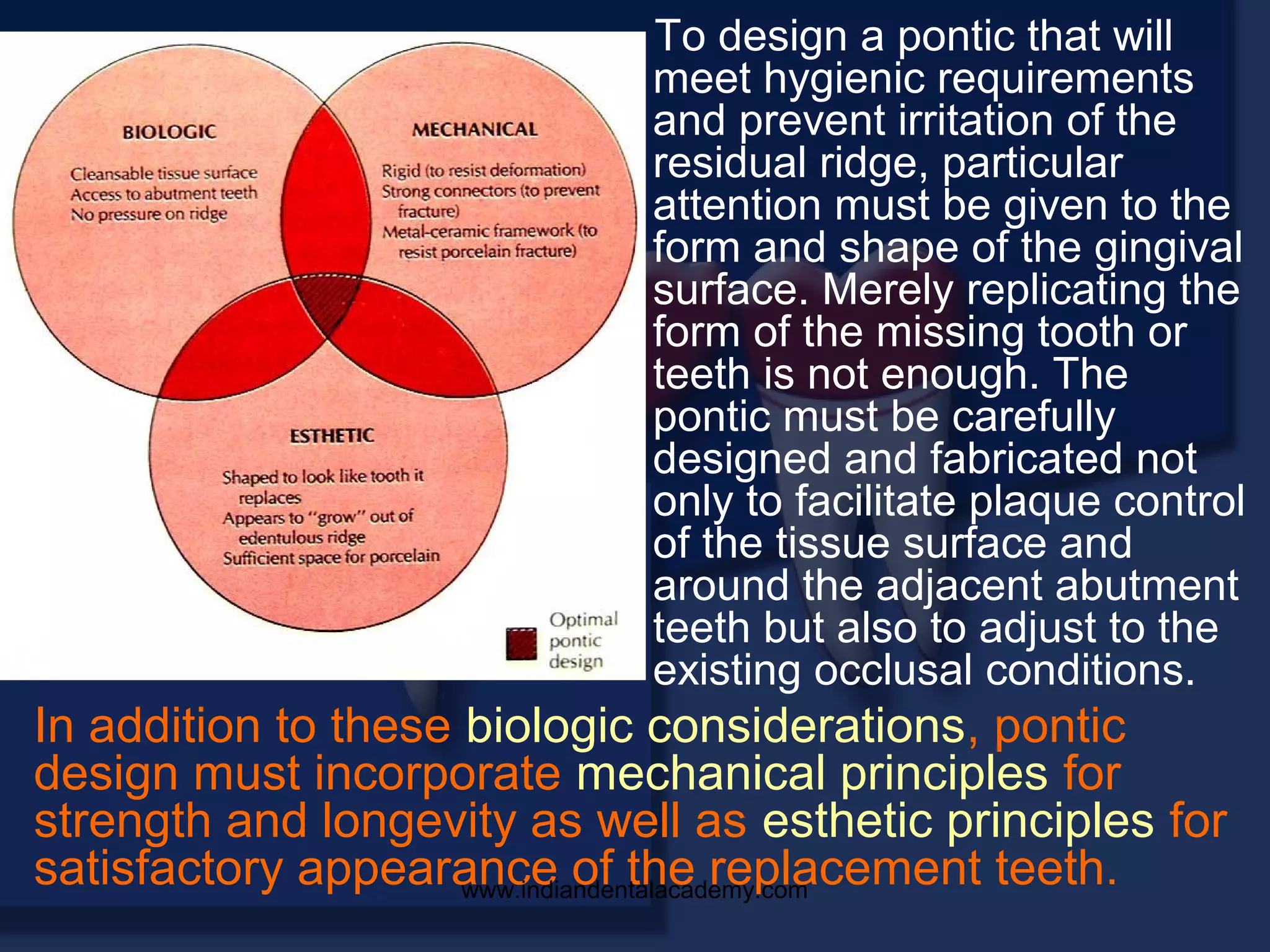 Pontics Design in fixed prosthodontics | PPT
