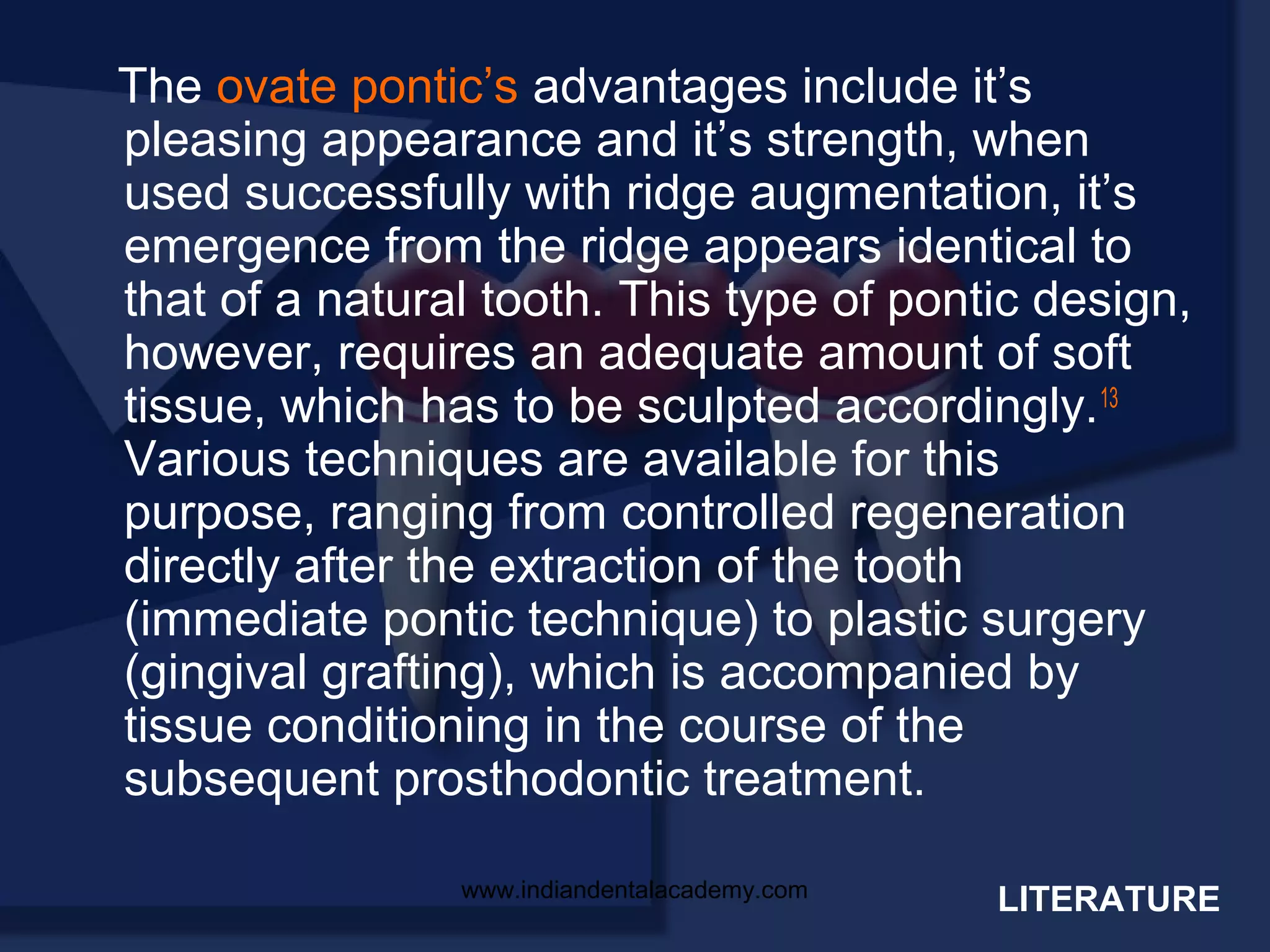 Pontics Design in fixed prosthodontics | PPT