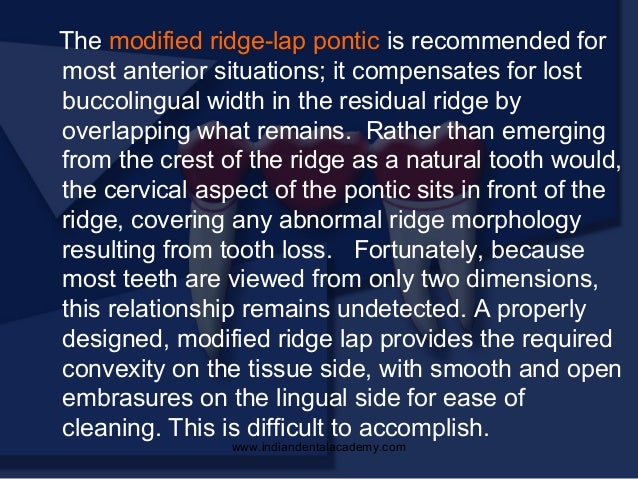 Pontics Design in fixed prosthodontics