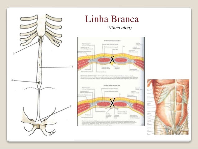 Pontos fracos da parede abdominal
