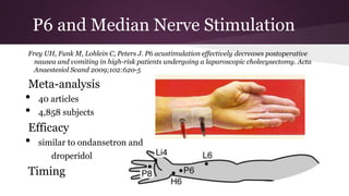 Exploration of Postoperative Nausea and Vomiting | PPTX