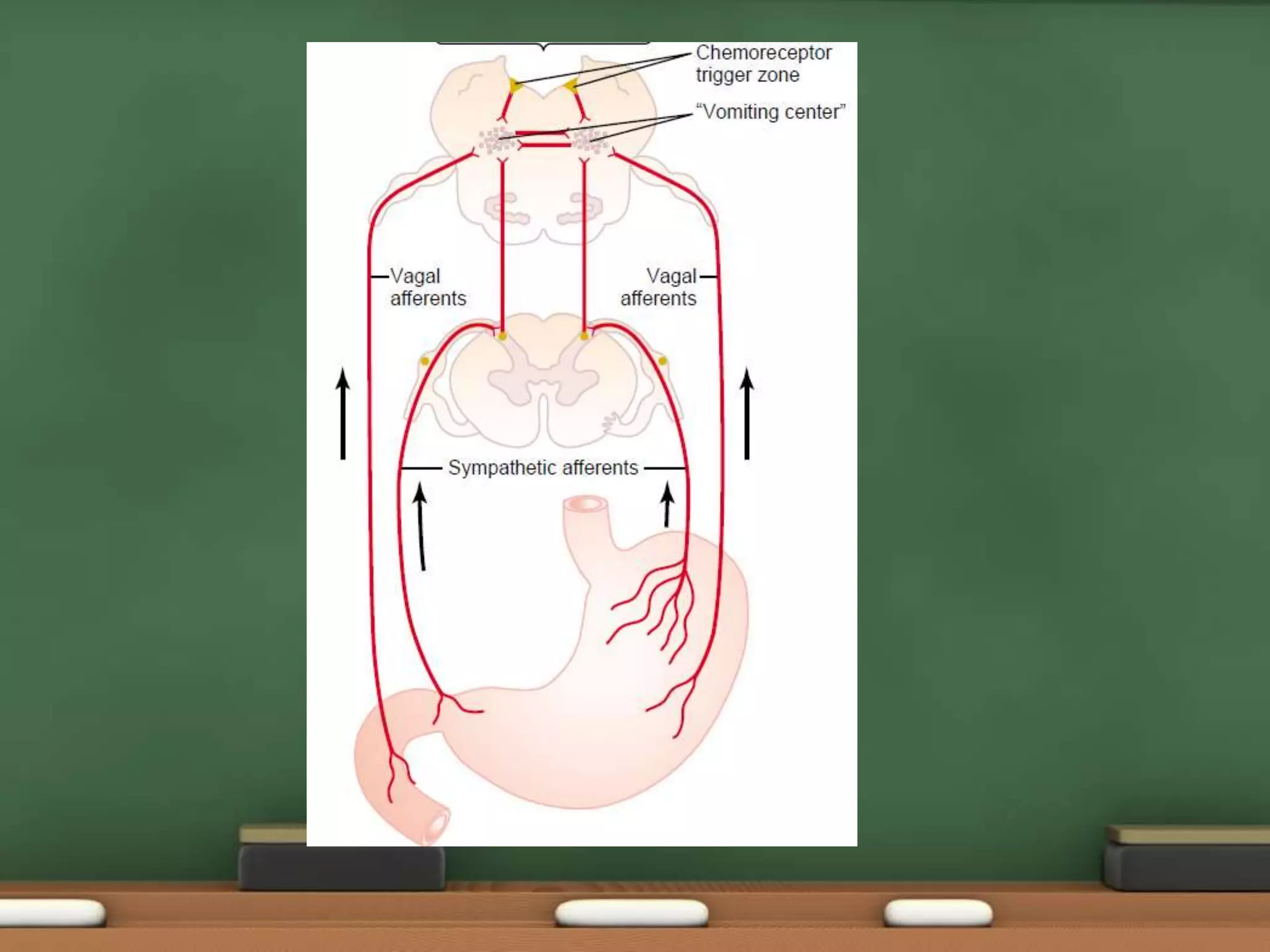 Post Operative Nausea & Vomiting | PPTX