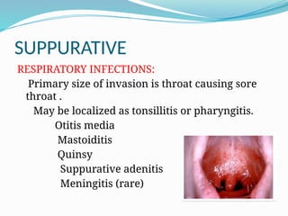 Streptococcus pyogenes ,Introduction,classification | PPTX