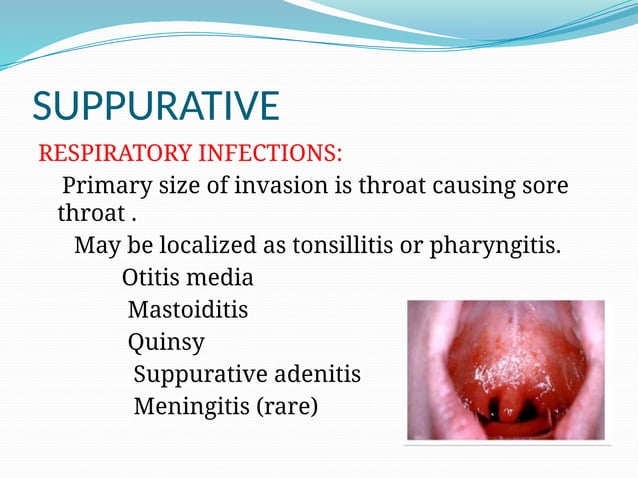 Streptococcus pyogenes ,Introduction,classification | PPT