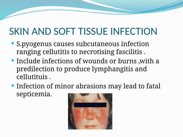 Streptococcus pyogenes ,Introduction,classification | PPT