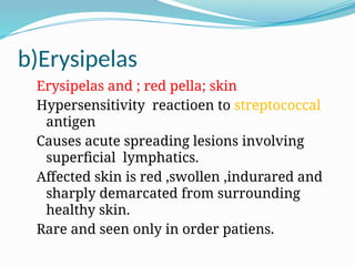 Streptococcus pyogenes ,Introduction,classification | PPTX
