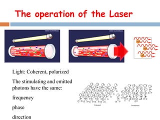 RUBY LASER | PPT