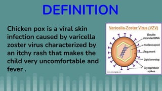 Chicken pox is a disease caused by the varicella zoster virus.it caused ...