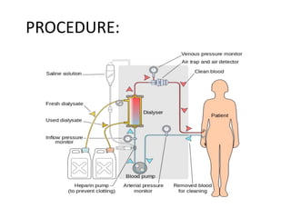 Hemodialysis Machine Diagram