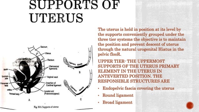 Retroverted uterus | PPTX