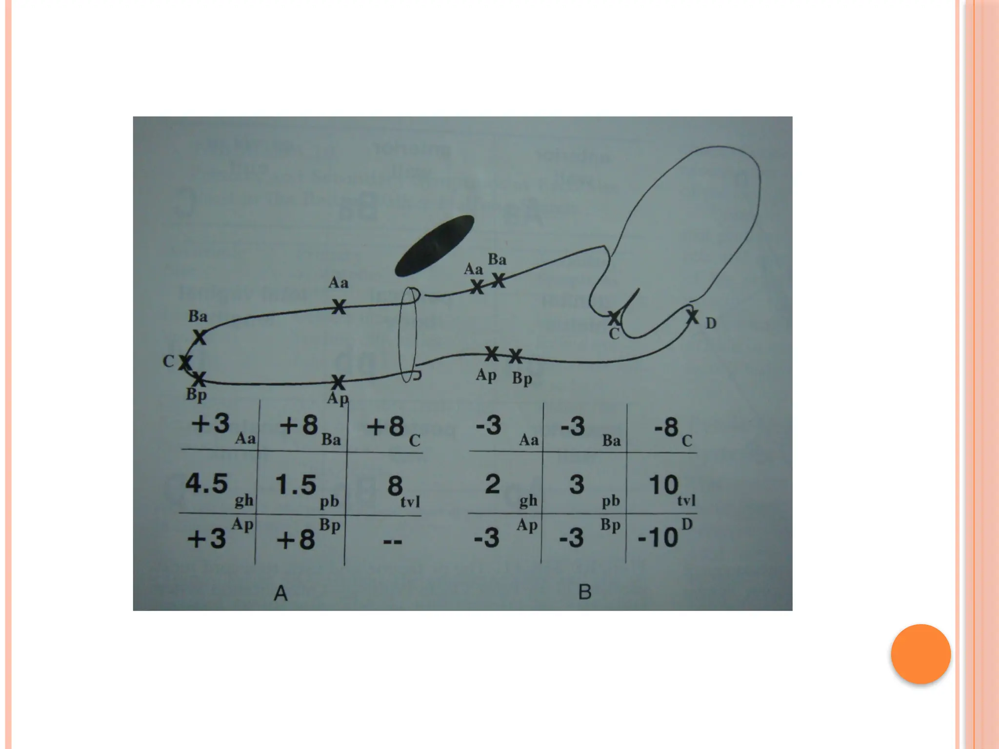 pop.pptx pelvic organ prolapse picturess | PPT