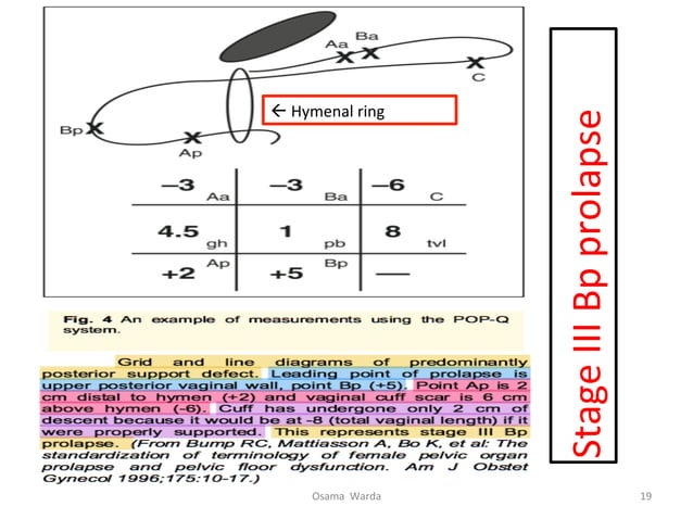 Pop q (new) | PDF | Reproductive Health | Diseases and Conditions