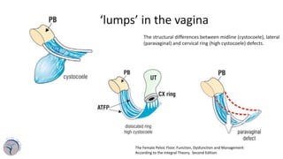 Pelvic anatomy in relation with pelvic organ prolapse | PDF
