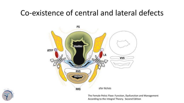 Pelvic anatomy in relation with pelvic organ prolapse | PDF