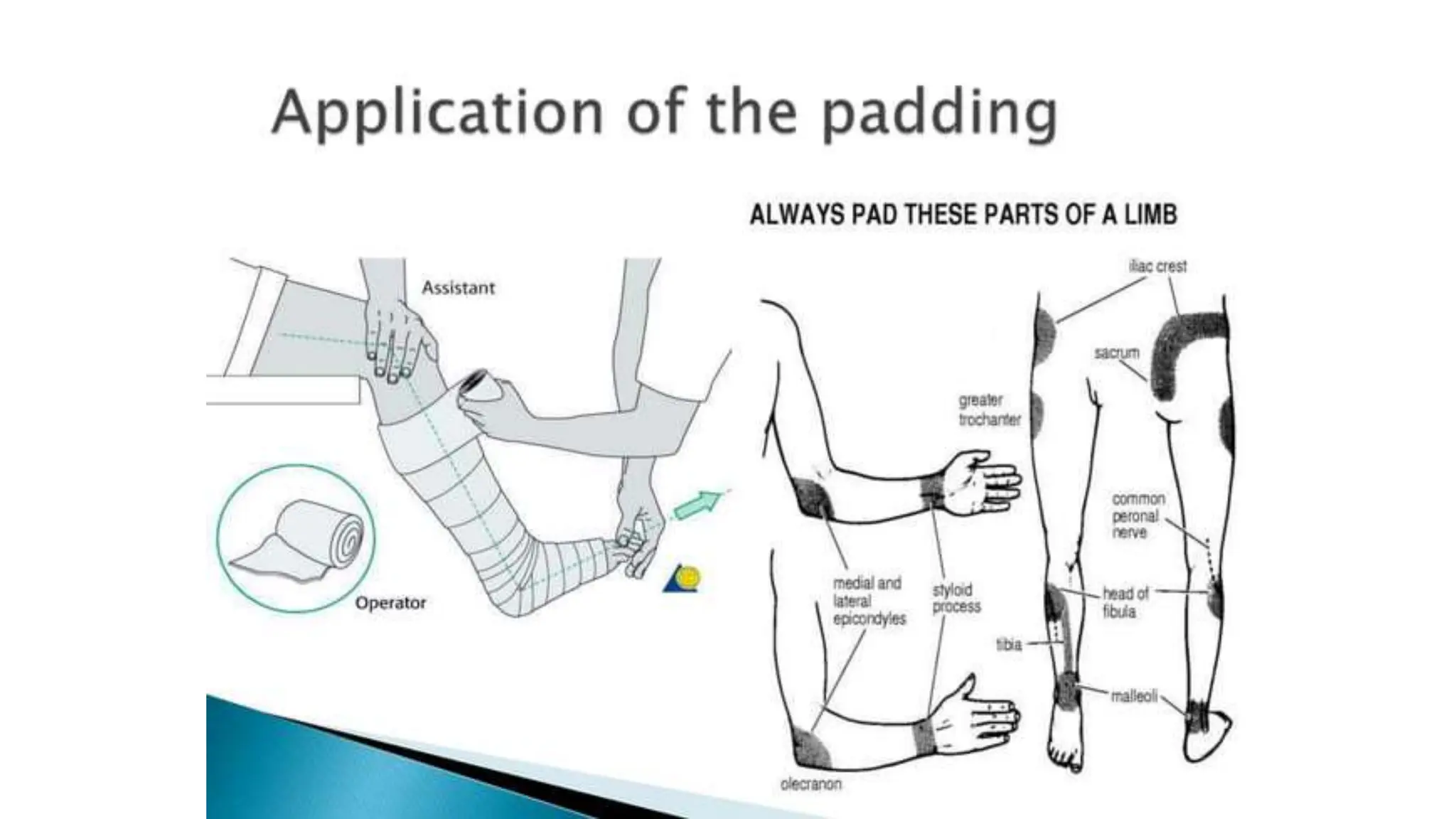 pop and bone cement orthopaedics ppt.pptx