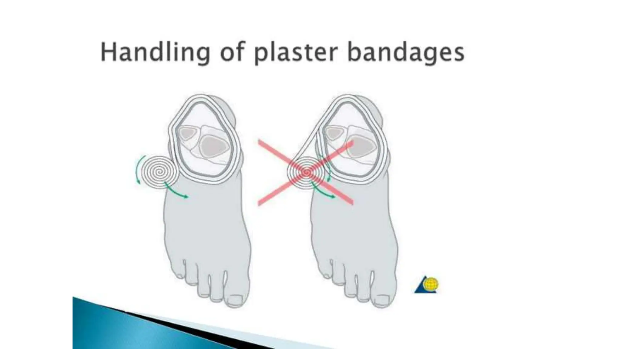 pop and bone cement orthopaedics ppt.pptx