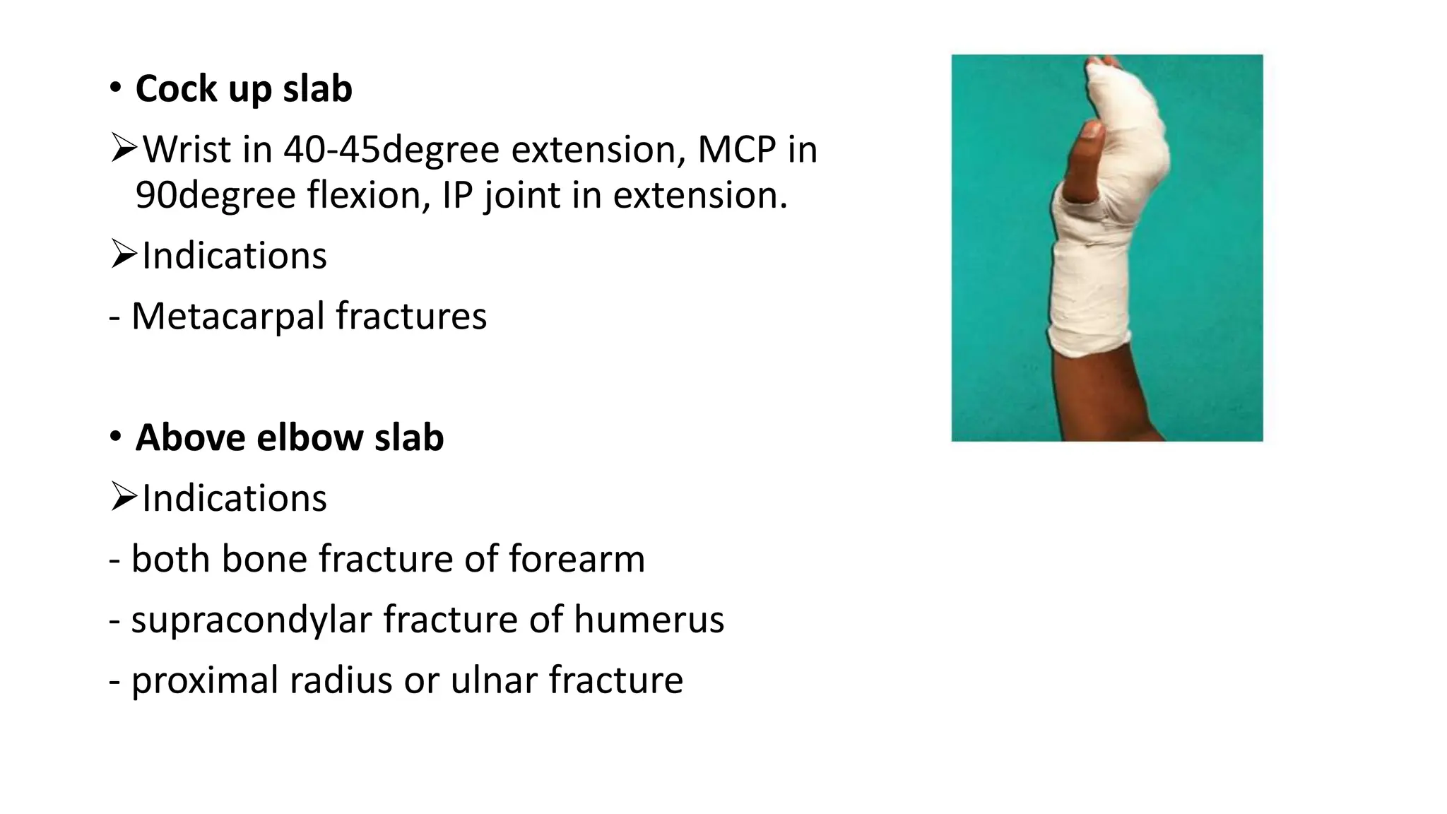 pop and bone cement orthopaedics ppt.pptx